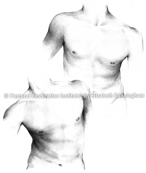 Bifarious - Postural Restoration Institute